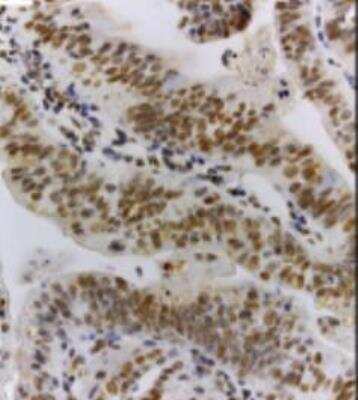 STAT3 [p Tyr705] Antibody (RM261) (NBP2-61588): Novus Biologicals